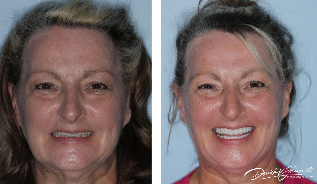 Faces of the Smile Gallery | Integrated Dentistry