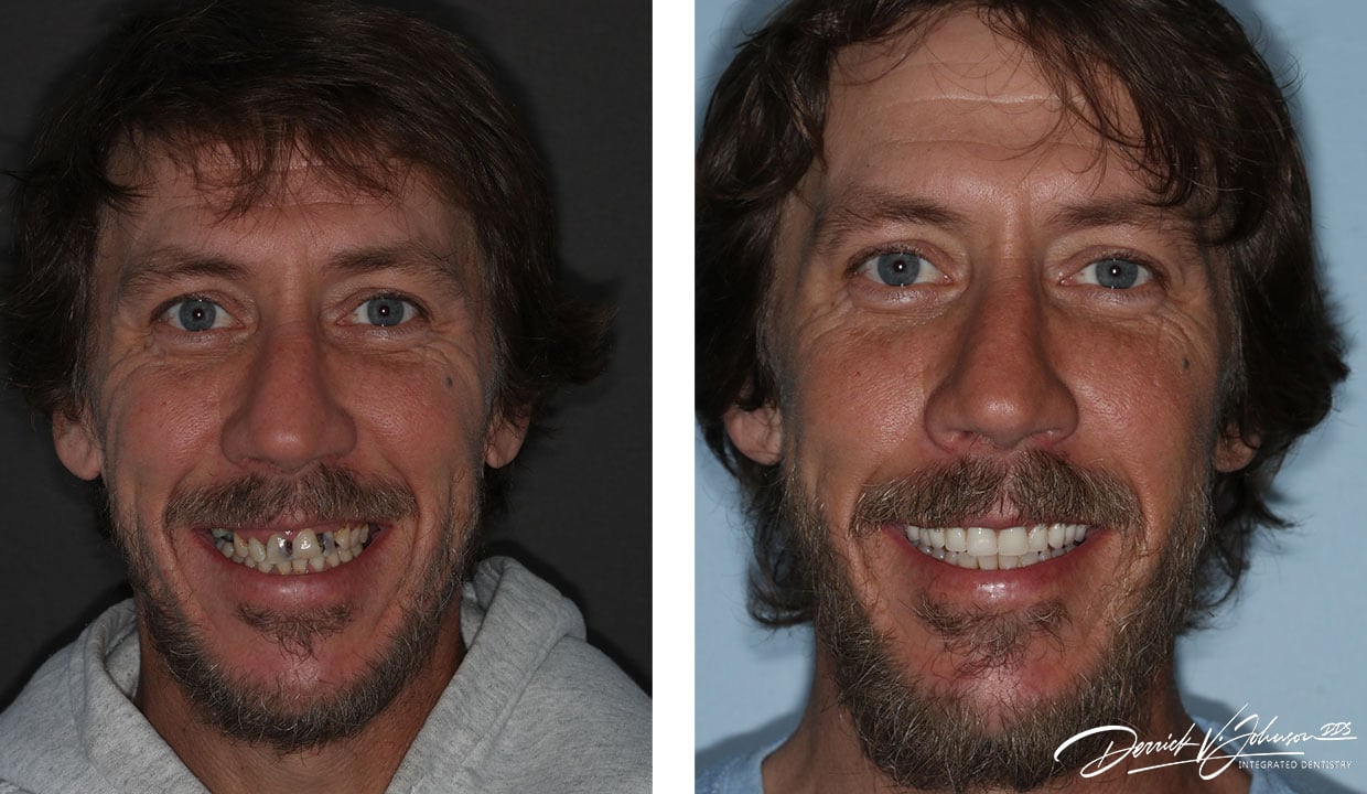 Faces of the Smile Gallery | Integrated Dentistry