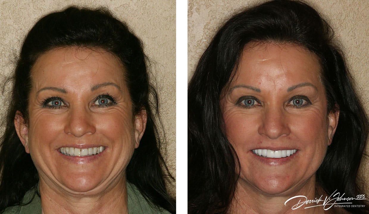 Faces of the Smile Gallery | Integrated Dentistry