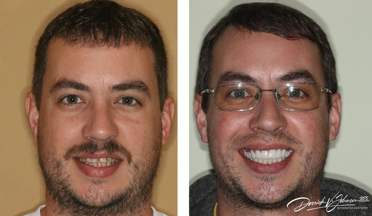 Faces of the Smile Gallery | Integrated Dentistry