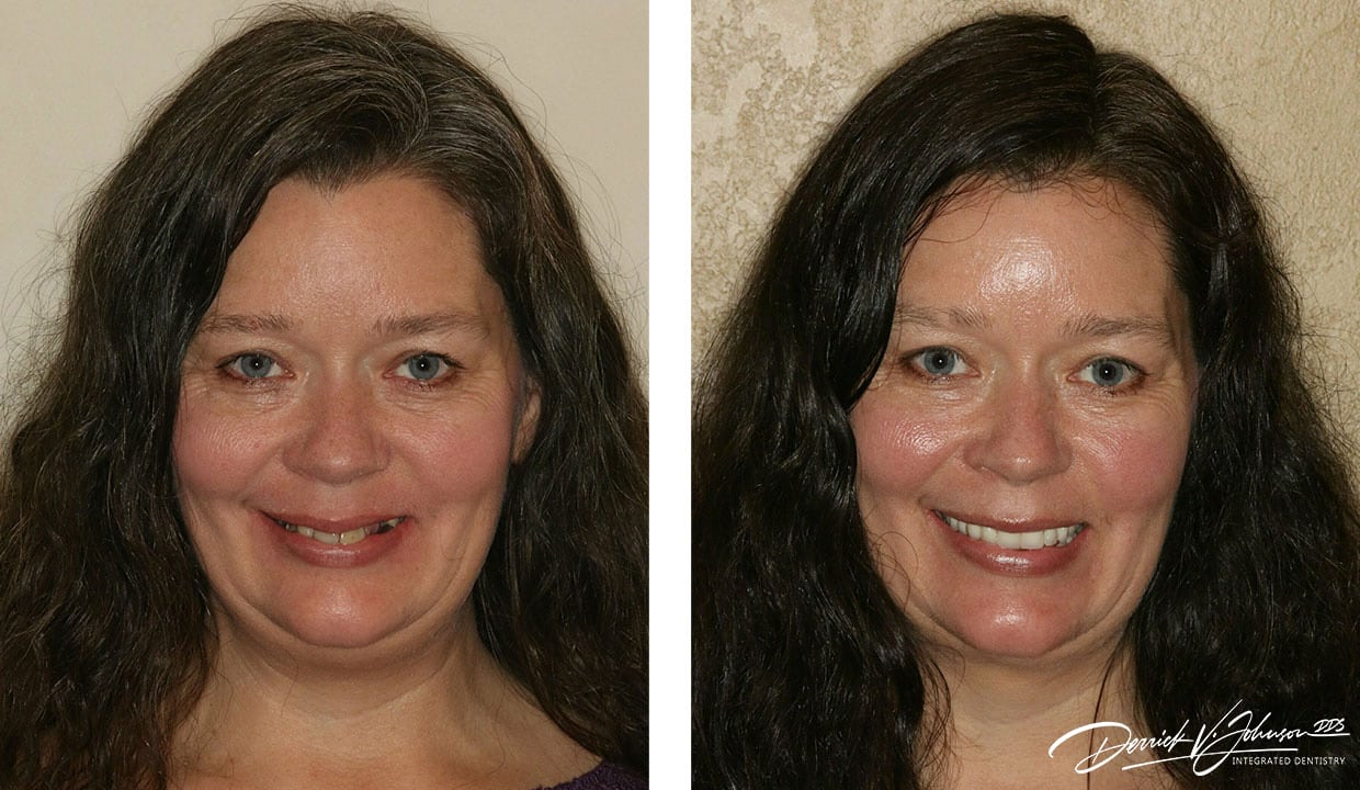 Faces of the Smile Gallery | Integrated Dentistry