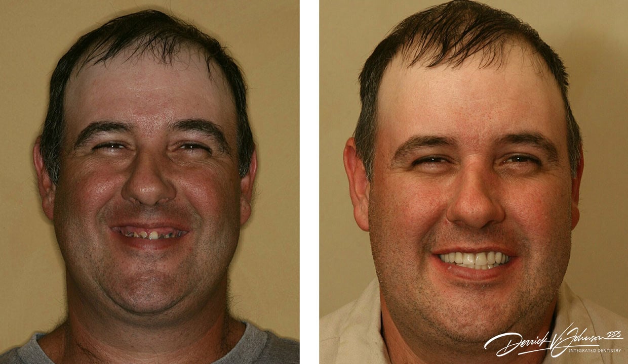 Faces of the Smile Gallery | Integrated Dentistry