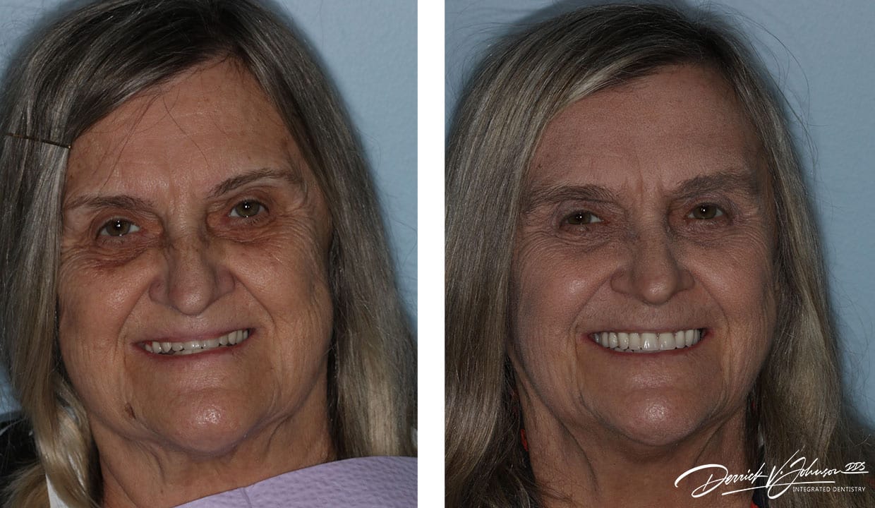 Faces of the Smile Gallery | Integrated Dentistry