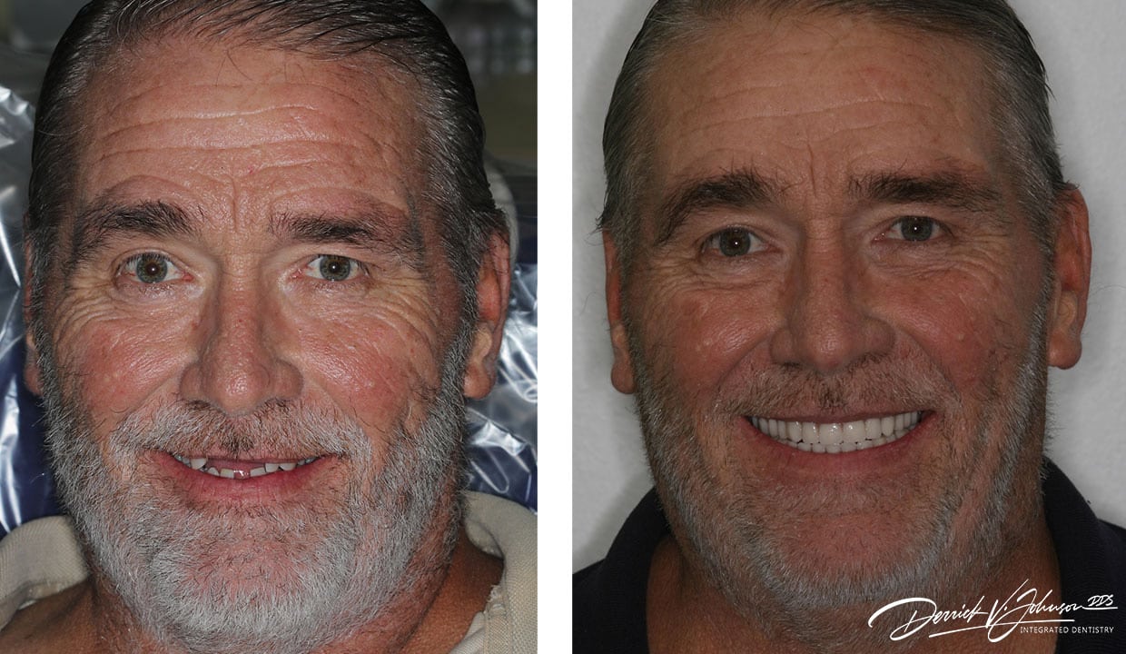 Faces of the Smile Gallery | Integrated Dentistry