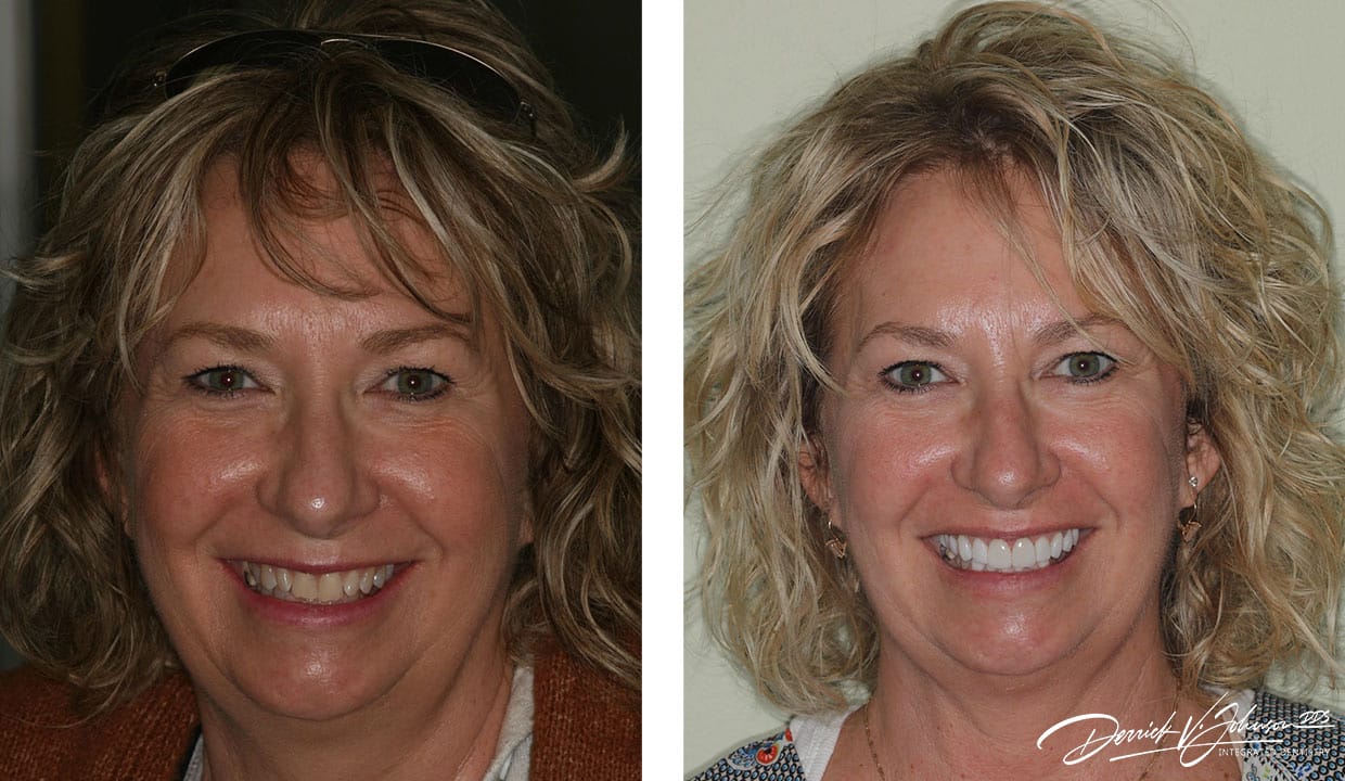 Faces of the Smile Gallery | Integrated Dentistry