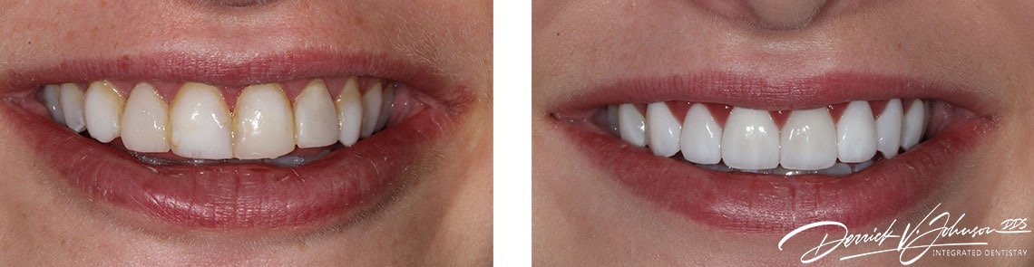 Close-Ups of Smile Gallery | Integrated Dentistry