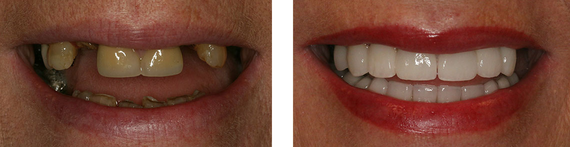 Close-Ups of Smile Gallery | Integrated Dentistry